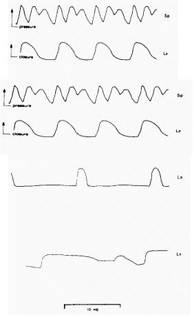 Laryngograph Ltd - Catalogue - Portable Laryngograph